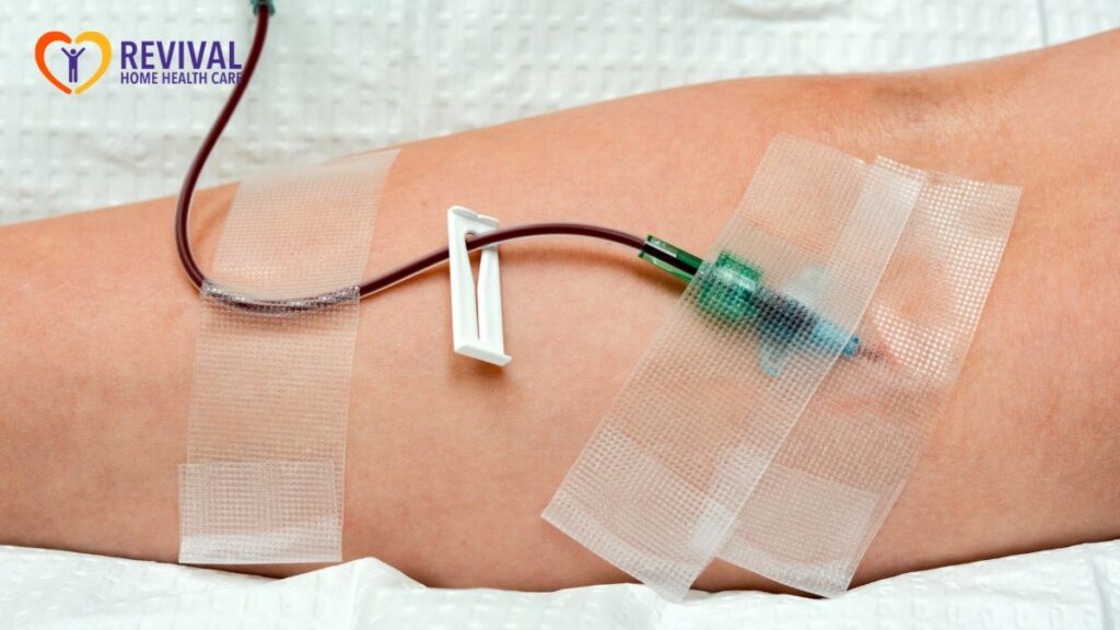 Ports vs. PICCs at Home: Pros, Cons, and Care Tips - Revival Home ...